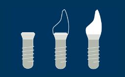 Healing of the Extraction Socket - Learning Modules - ITI