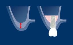 The SAC Classification - Assessments - ITI