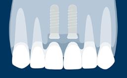 The SAC Classification - Assessments - ITI